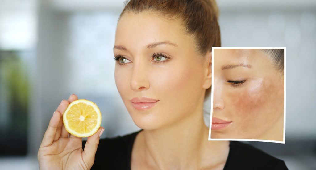 Macchie solari sulla pelle: cause e rimedi | Trucchi.tv