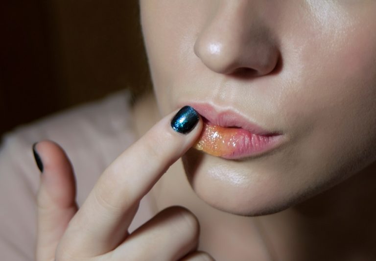 Labbra screpolate? Ecco tutte le cause e i rimedi da provare | Trucchi.tv