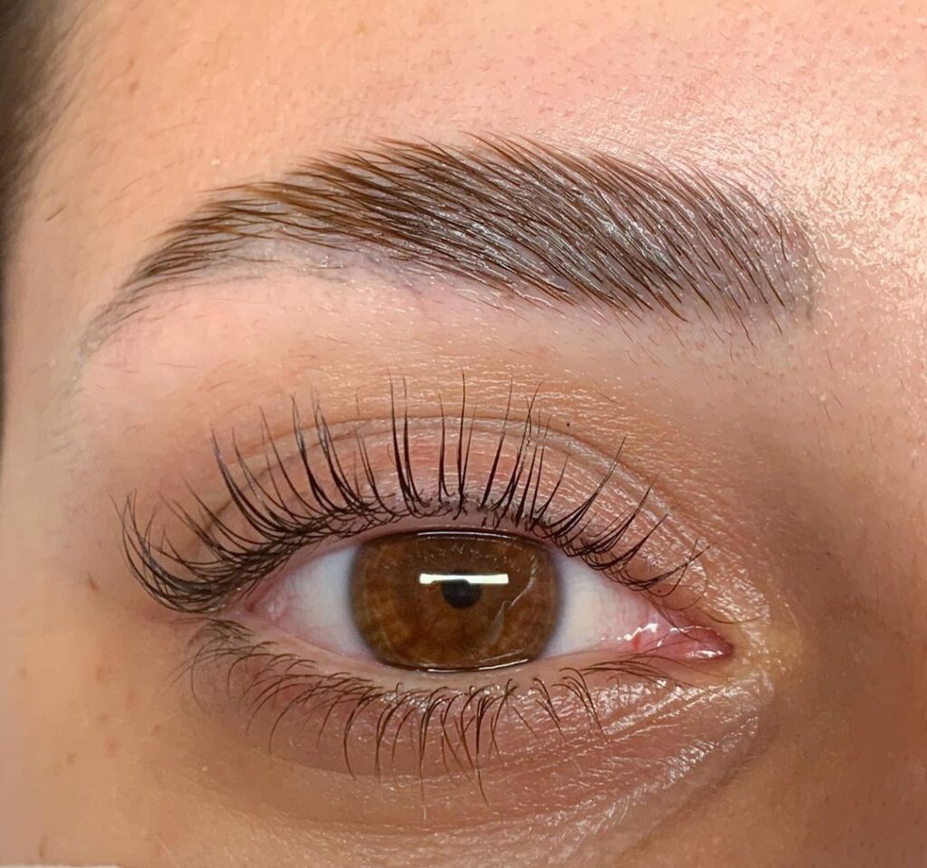 LAMINAZIONE SOPRACCIGLIA, cos'è, risultati e quanto costa