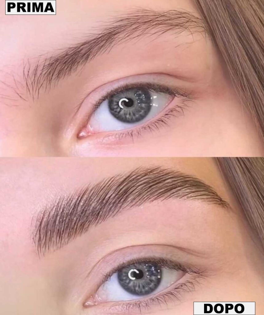 LAMINAZIONE SOPRACCIGLIA, cos'è, risultati e quanto costa